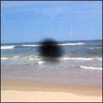 Scotoma – Causes, Symptoms, Treatment, Prognosis and Prevention